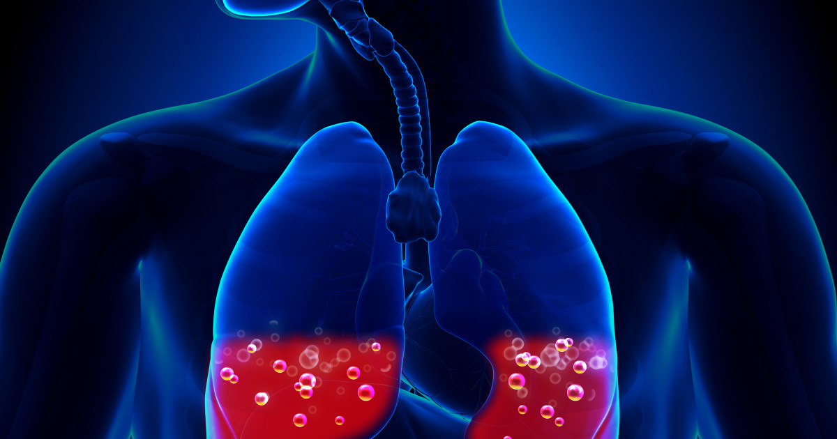 Promising Therapeutic Target for High-Altitude Pulmonary Edema (HAPE ...